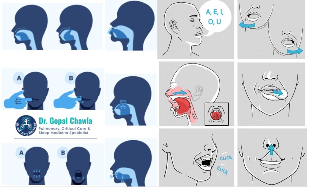 Effective Exercises for Sleep Apnea: A Pulmonologist’s Guide – Dr ...