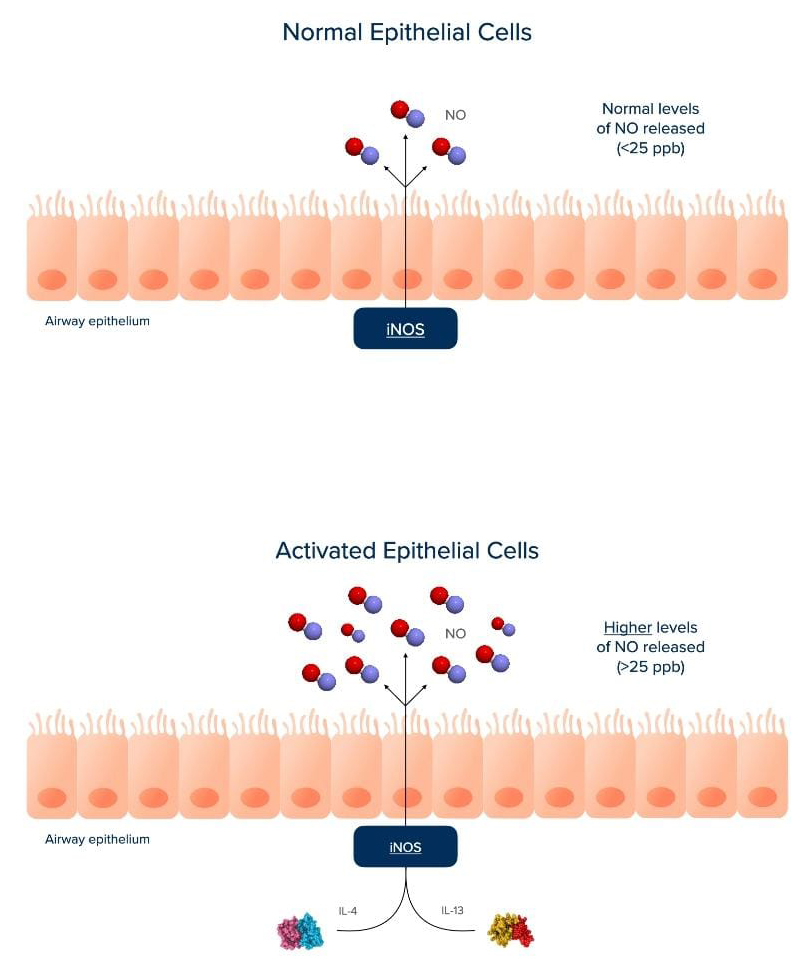 FeNO (Fractional exhaled Nitric Oxide) – Dr. Gopal Chawla